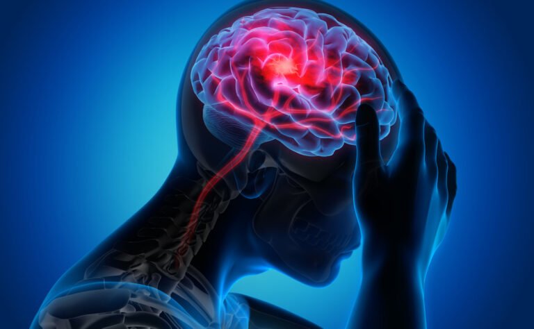 Αγγειακό εγκεφαλικό επεισόδιο